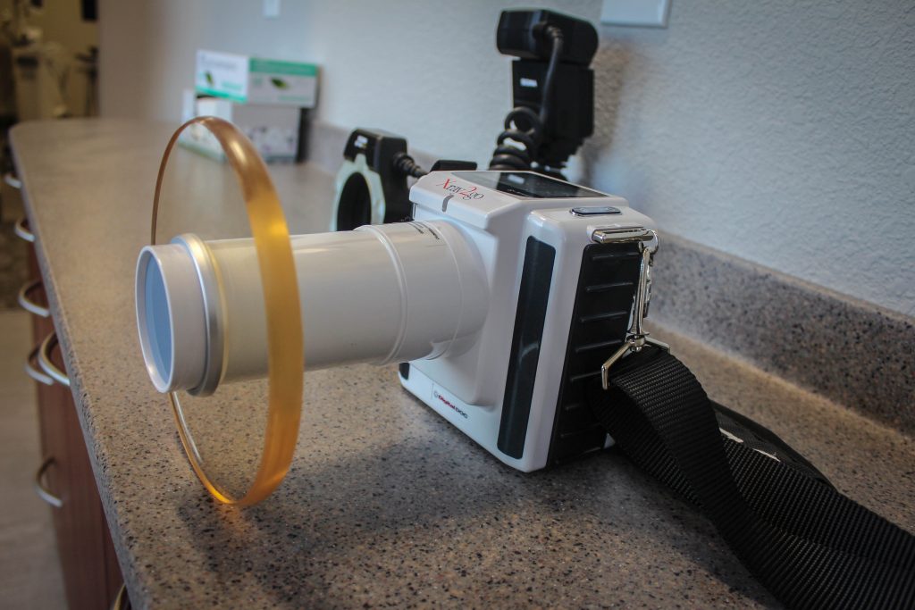 Digital X-Ray Cameras | Dentist in Virginia Beach, VA